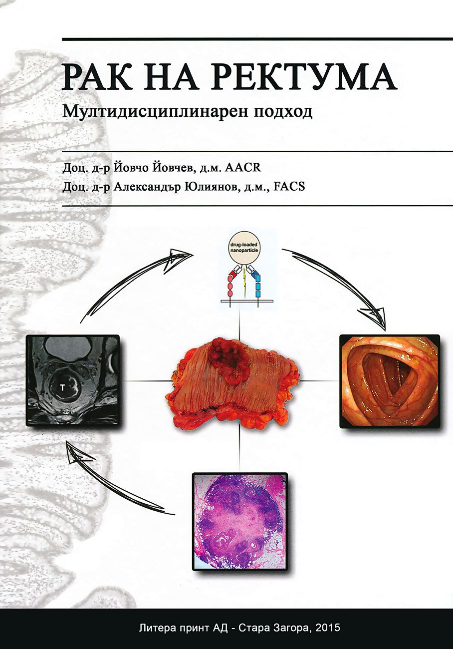 Рак на ректума. Мултидисциплинарен подход - книга - store.bg